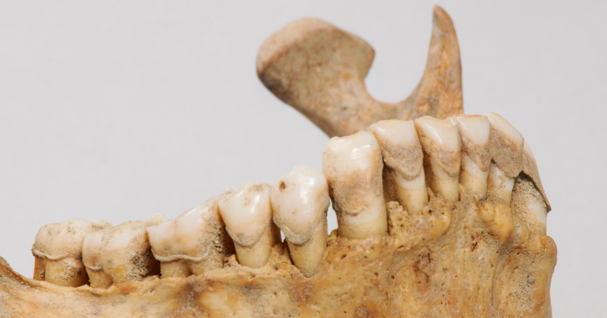 Mummy research: Ancient dental calculus - new insights into the ...